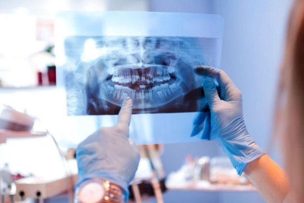 Dental X-Rays (Types and Uses Guide)