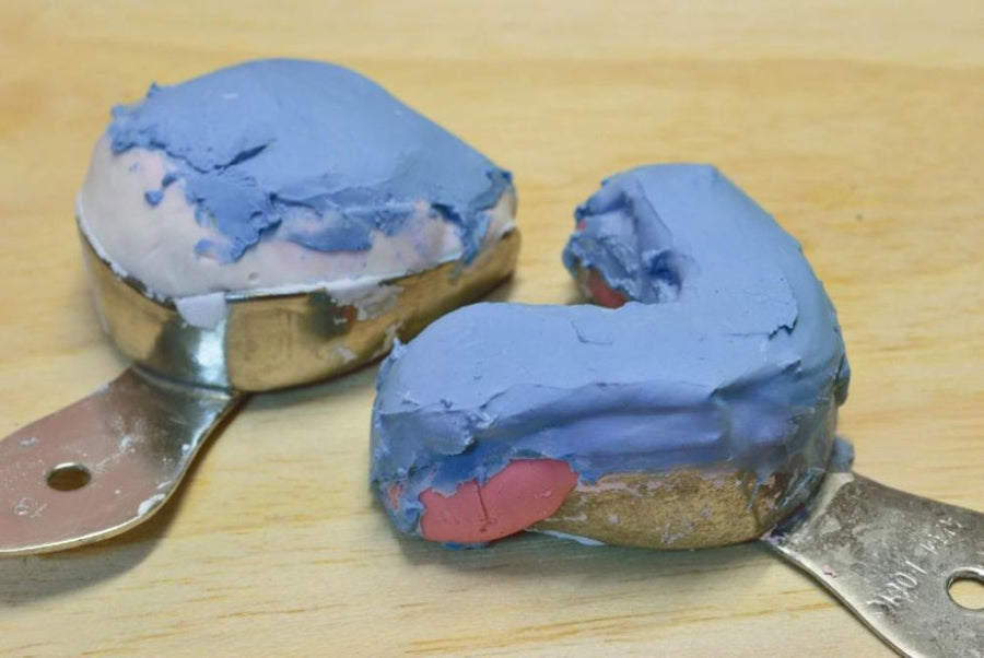 What Is an Impression Coping: A Dental Guide