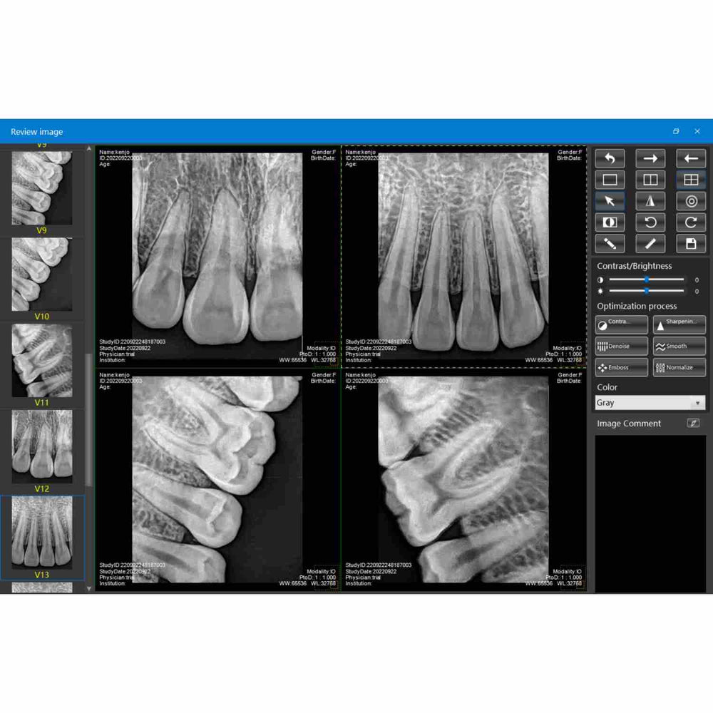 Dental X Ray Sensor, Portable Digital RVG Intraoral Sensor